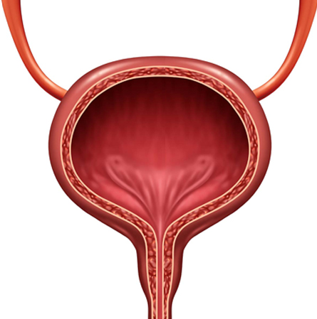 Bladder Cancer Stem Cell Therapy - Stem Cell Tijuana